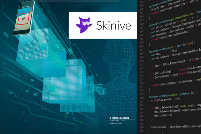 How Machine Learning (AI) Technology Detects Skin Diseases?