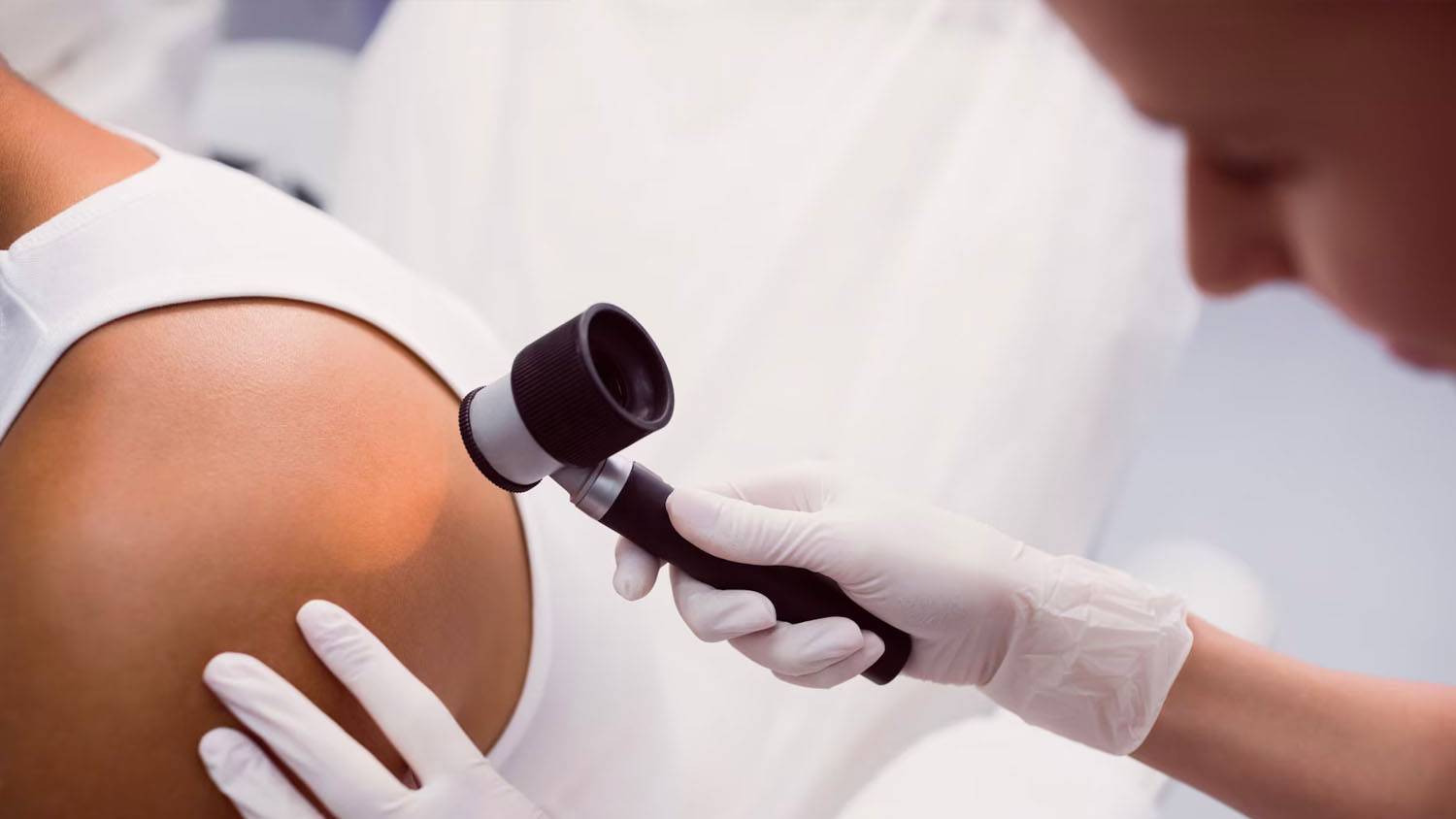 The Spectrum of Skin Pigmentation and Discoloration: Types, Prevention ...