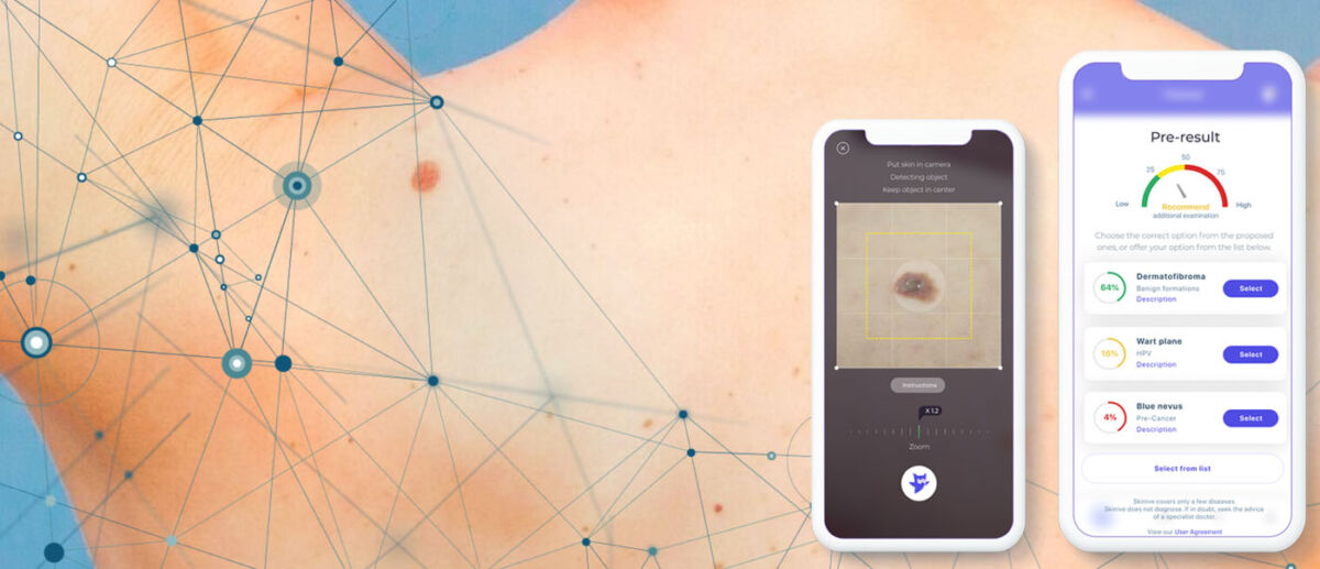 Analysis of Skinive algorithm’s accuracy for risk assessment of skin ...
