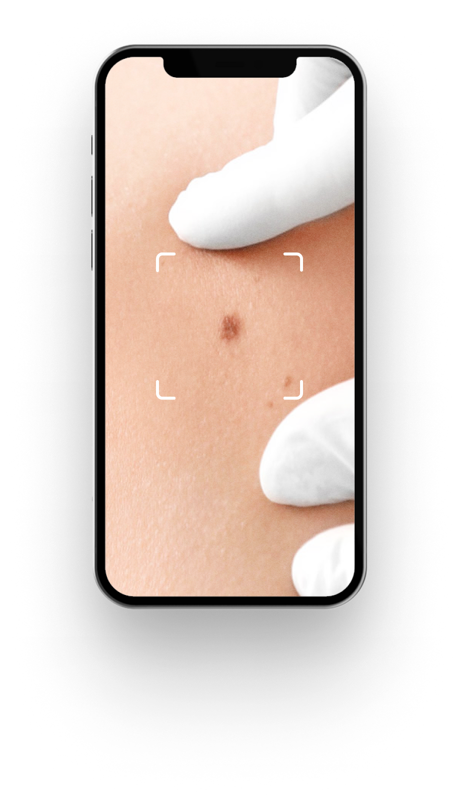 For doctors - Skinive: Skin Health AI-Tracking apps
