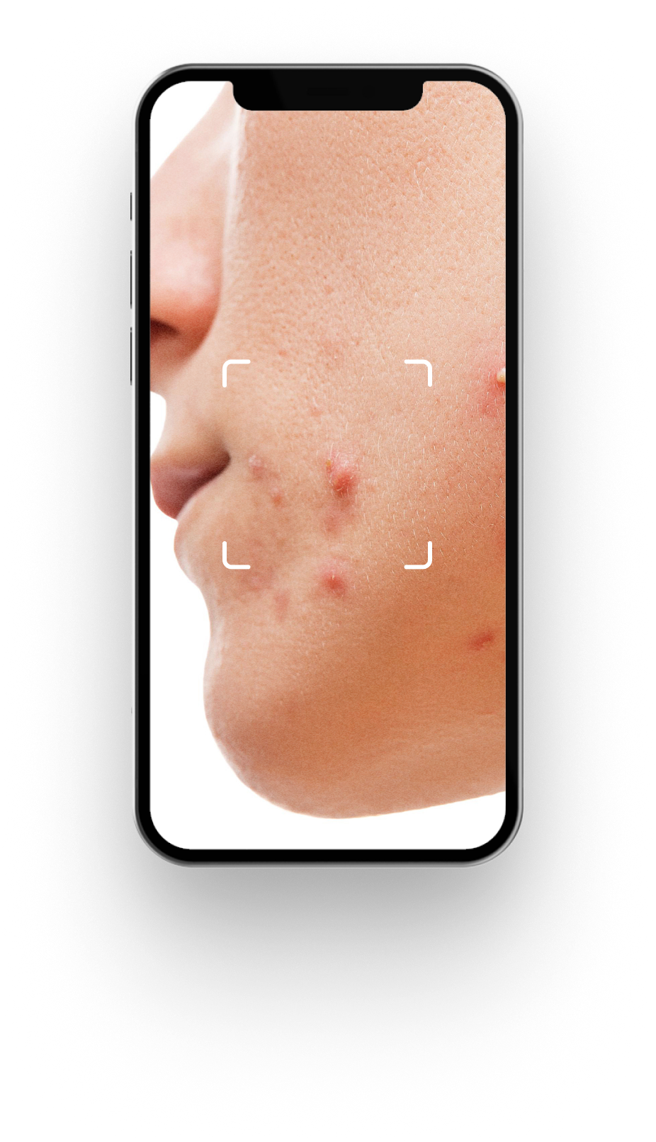 For doctors - Skinive - Free AI Dermatologist