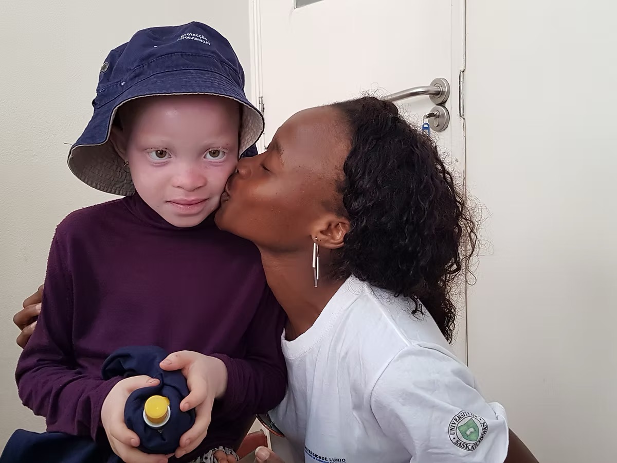 Albinism, Sun, and Skin Health: Why Protection and Early Detection Save ...